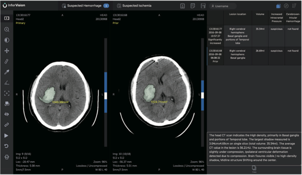deepcOS - AI portfolio